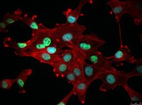 12Z Human Endometrial Epithelial Cell Line | SCC443
